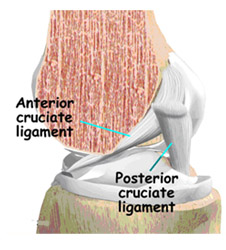 Sports Arthroscopy India :: ACl Reconscruction,Acl injury,Arthroscopy ...